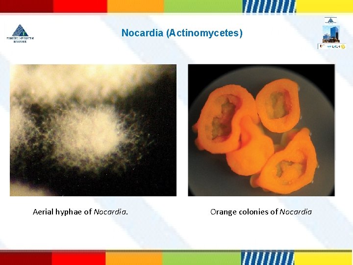 Nocardia and Anaerobic bacteria Nocardia Actinomycetes Nocardia ...