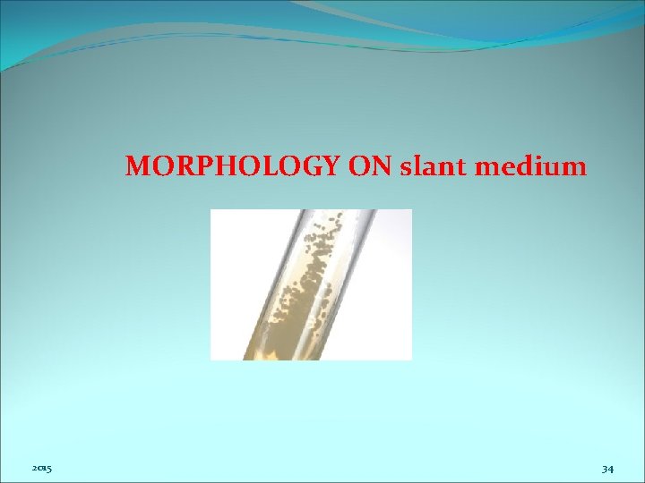 Lab 5 2015 1 Purification of microorganism Culture