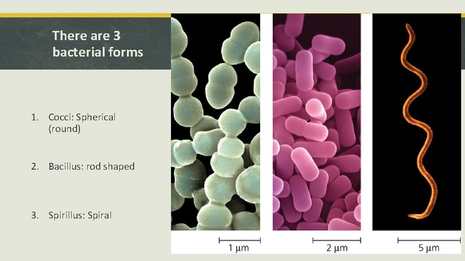 Title Layout Subtitle There are 3 bacterial forms