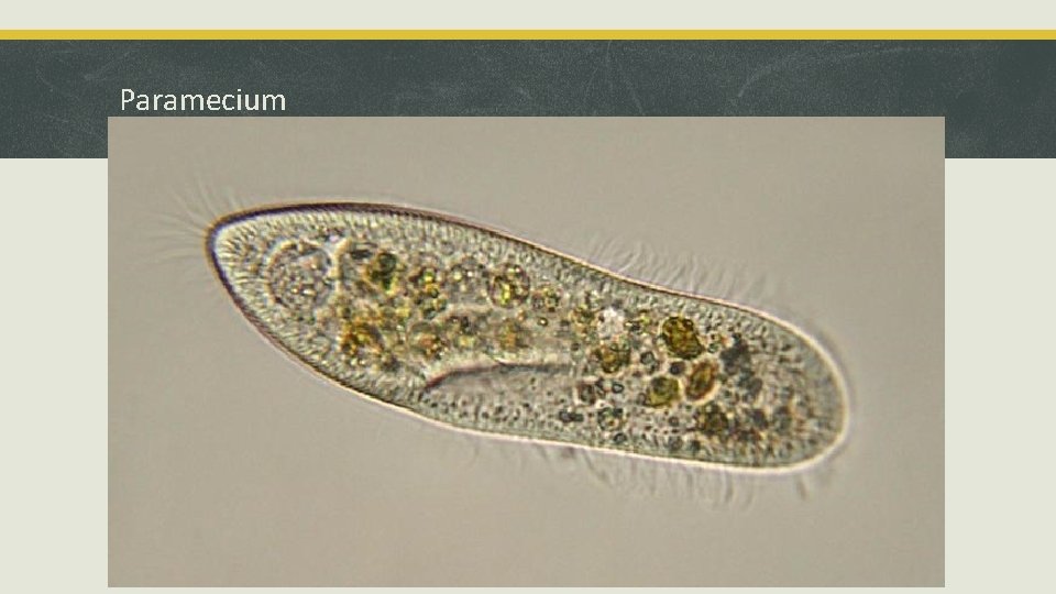 Title Layout Subtitle There are 3 bacterial forms