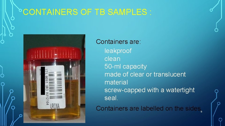 HOW IS TB TRANSMITTED The TB bacilli are