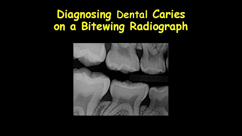 Radiography for Children Radiographs Supplemental Data Base Radiographs