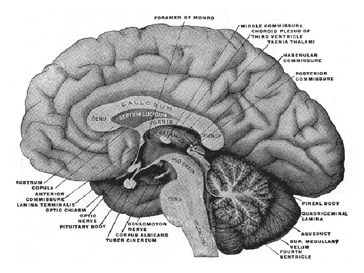 Edema Increased water in brain parenchyma Types of