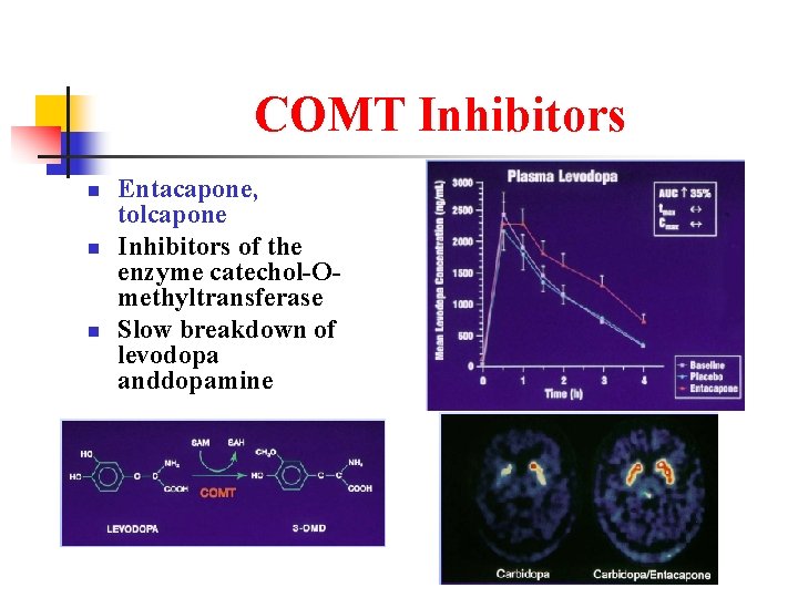 Treatment of Parkinsons Disease and Movement Disorders David