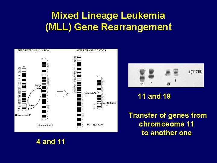 Multidimensional Genomic Profiling of Acute Leukemias Characterized by