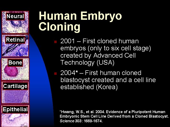 Prop 71 Stem Cell Hype and Hope Richard