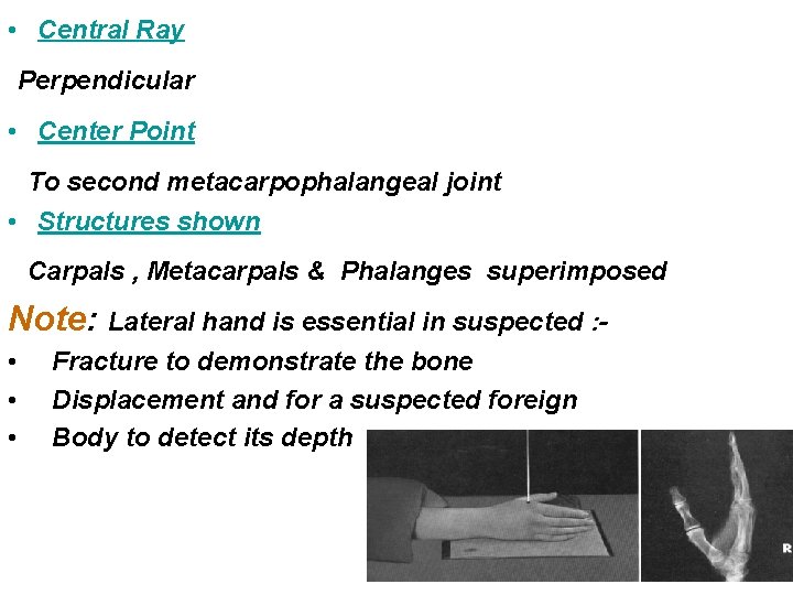 Lecture 5 Radiography of the Upper limbs 1