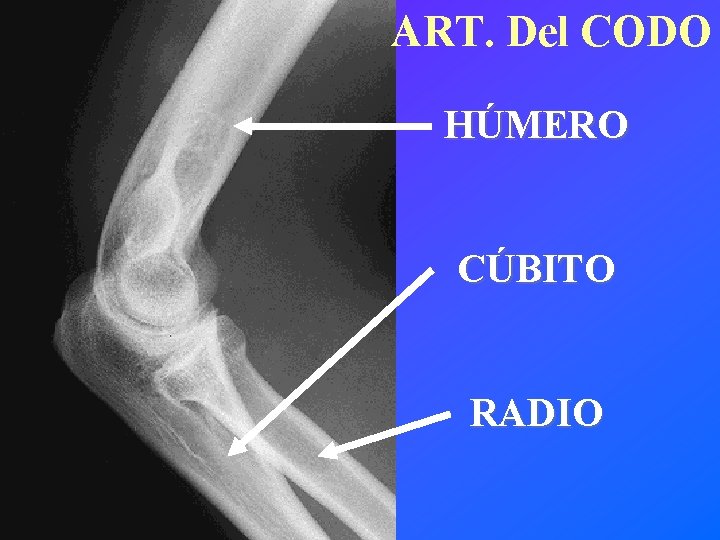 Tema 3 3 MIEMBRO SUPERIOR MSCULOS y MOVIMIENTOS