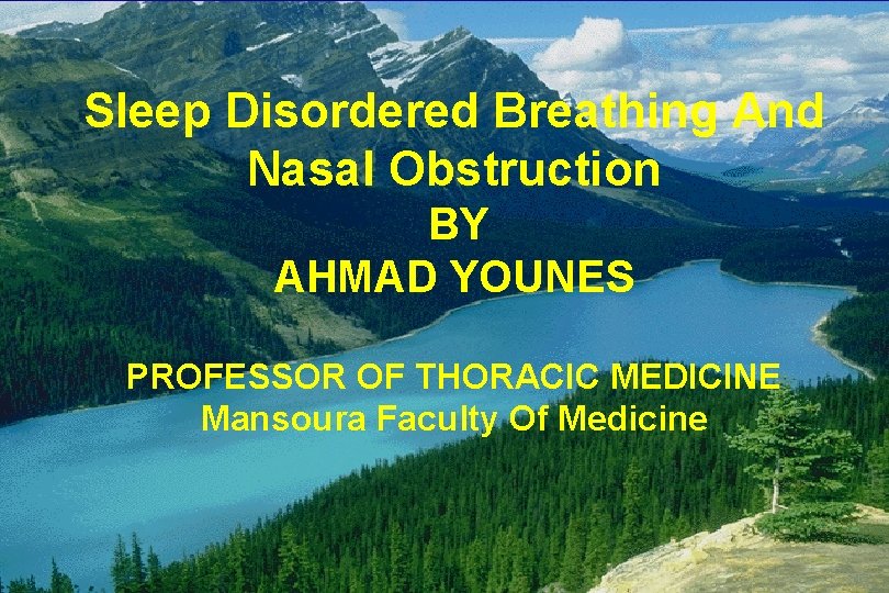 Sleep Disordered Breathing And Nasal Obstruction BY AHMAD