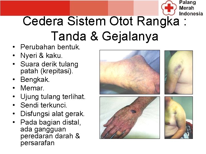 TRAUMA 2 Cedera Sistem Otot Rangka Macam Penyebabnya