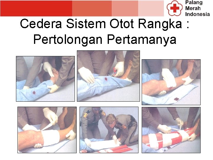 TRAUMA 2 Cedera Sistem Otot Rangka Macam Penyebabnya
