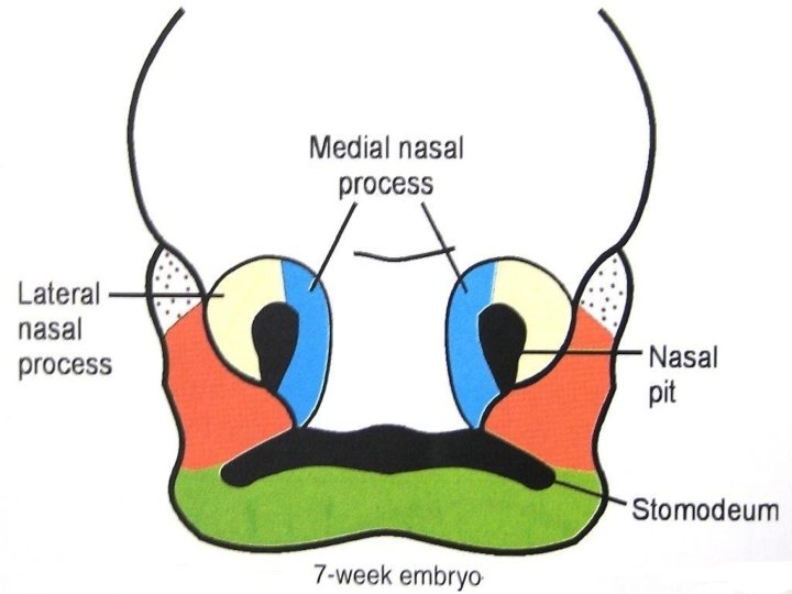 Anatomy of Nose Paranasal Sinuses Dr Vishal Sharma