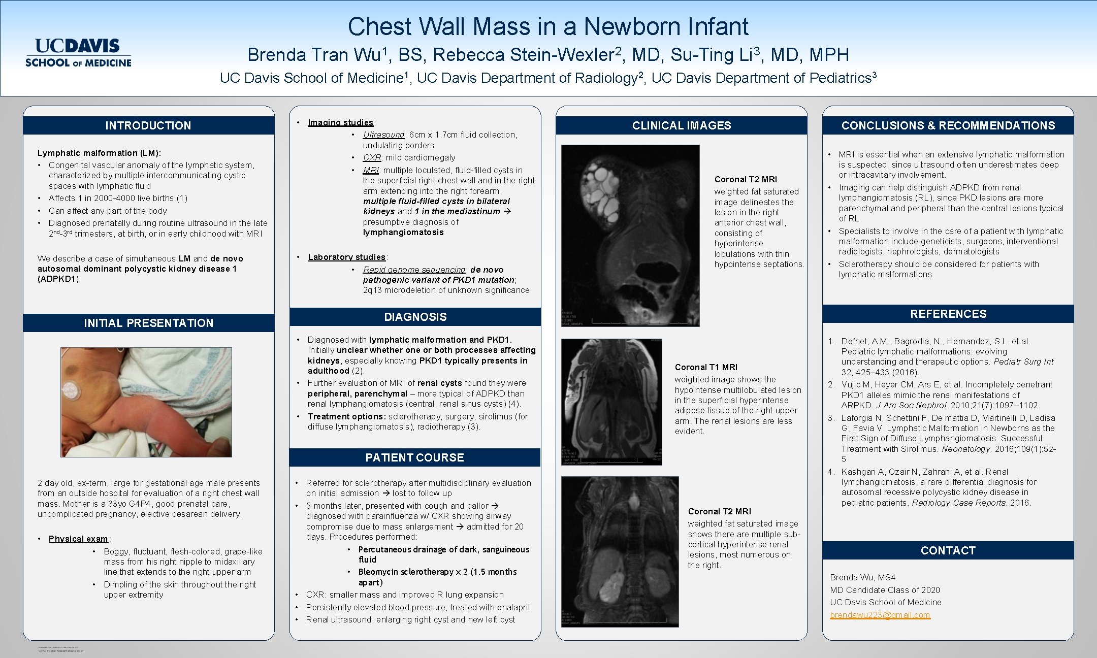 Chest Wall Mass in a Newborn Infant Brenda