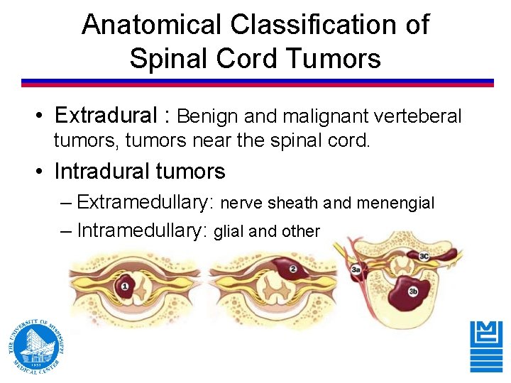 Primary Spinal Tumors Soft tissue tumors H Louis
