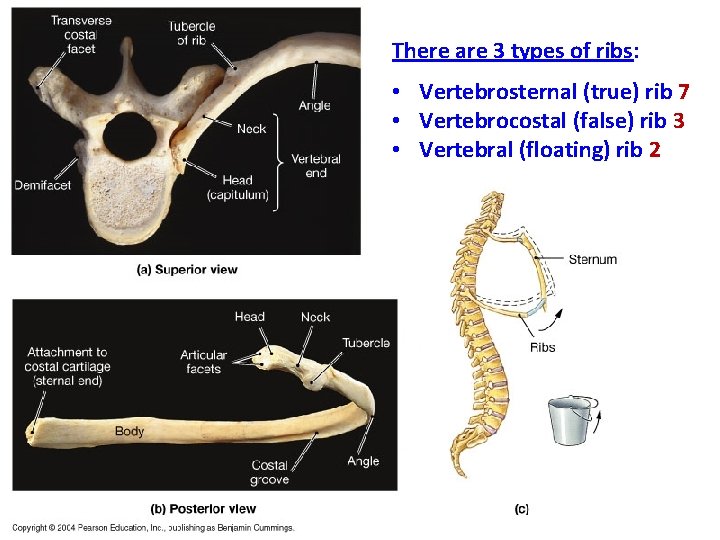 BONES Axial Skeleton Cranial Bones Facial Bones Cranial