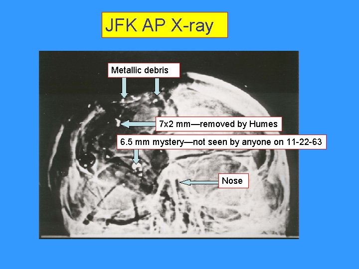 The JFK Skull Xrays Evidence for Forgery David