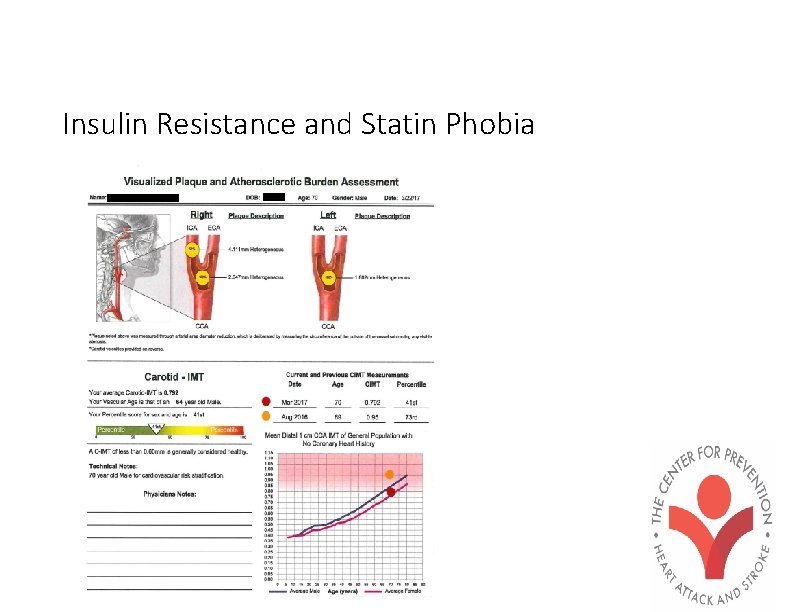 The Center for Prevention Heart Attack and Stroke