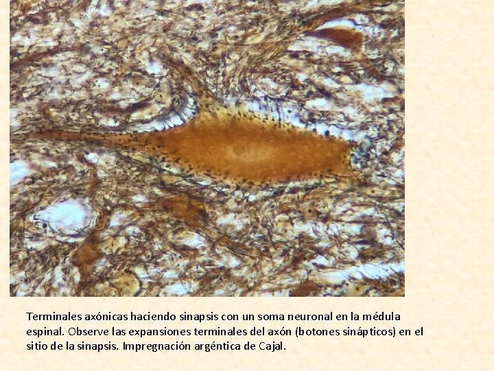 TRANSMISIN DE IMPULSOS NERVIOSOS DE NEURONA A NEURONA