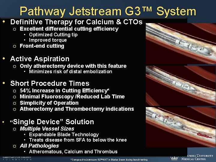 Pathway Jetstream G 3 A Rotational Flushing and