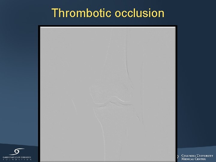 Pathway Jetstream G 3 A Rotational Flushing and