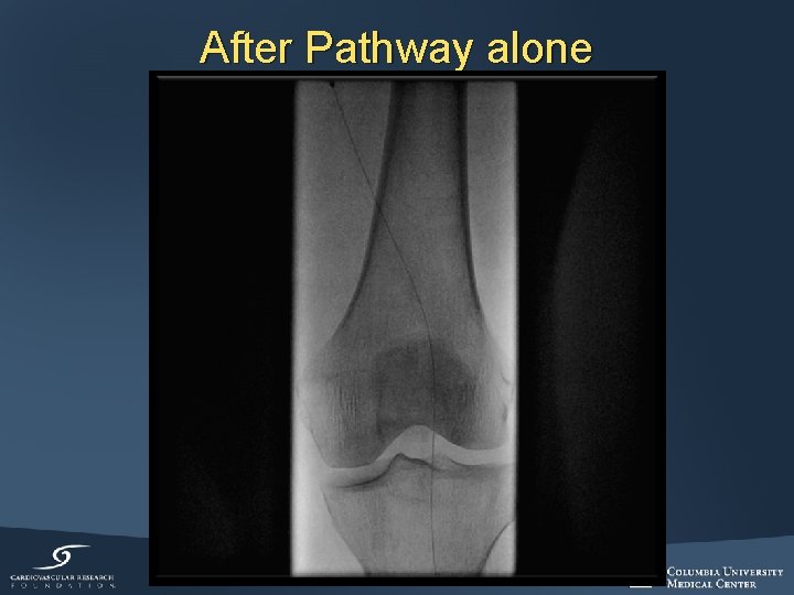 Pathway Jetstream G 3 A Rotational Flushing and