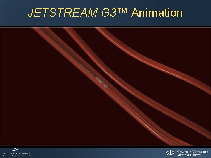 Pathway Jetstream G 3 A Rotational Flushing and