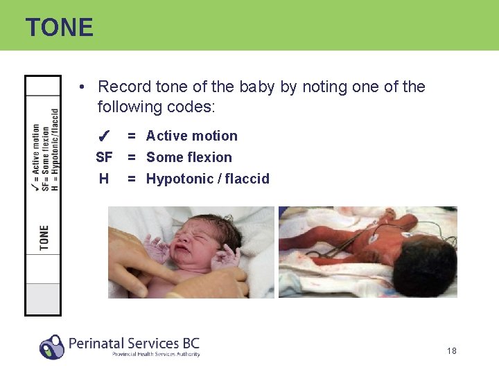 BC Newborn Resuscitation Record PSBC 1980 June 2019