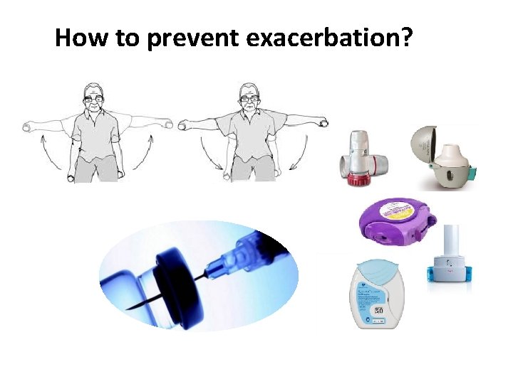 Prediction and management of COPD exacerbation Miguel RomnRodrguez