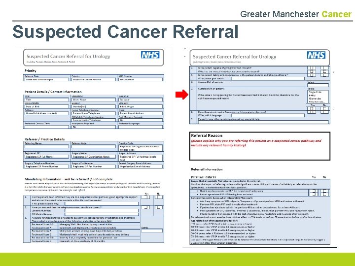 Greater Manchester Cancer Suspected Prostate Cancer Best Timed
