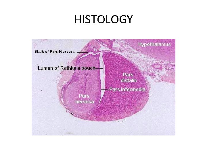 PITUITARY GLAND HYPOPHYSIS CEREBRI BY DR SHIVRAM BHAT