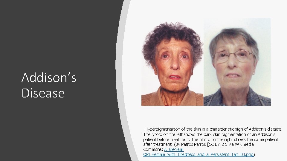 Adrenal Glands Introduction to the Adrenal Glands The