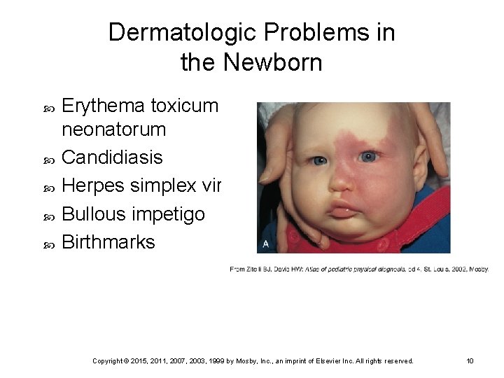 Chapter 8 Health Problems of Newborns Copyright 2015