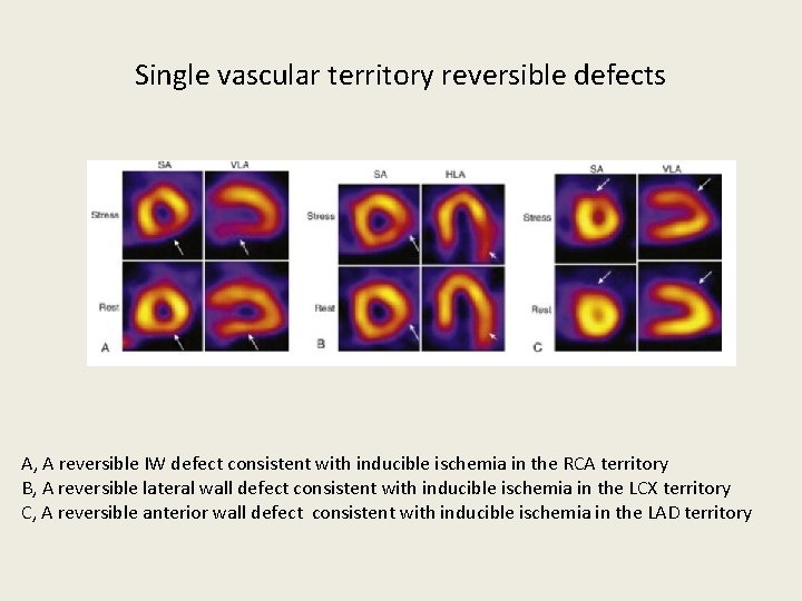 Nuclear imaging Basics Role in CAD History Myron