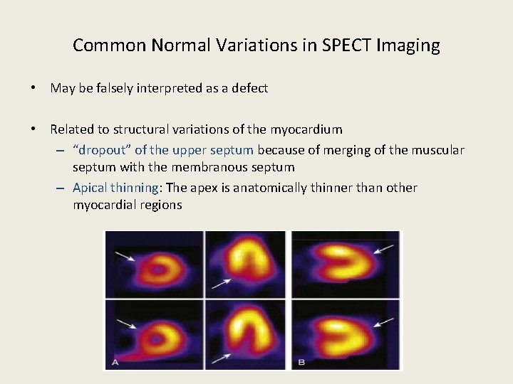 Nuclear imaging Basics Role in CAD History Myron