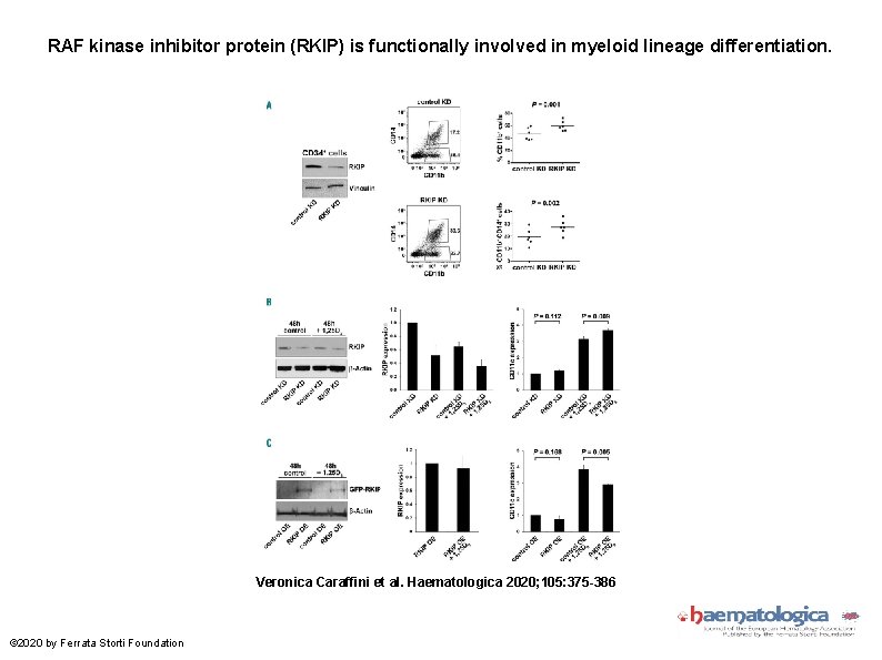 Loss of RAF kinase inhibitor protein is involved