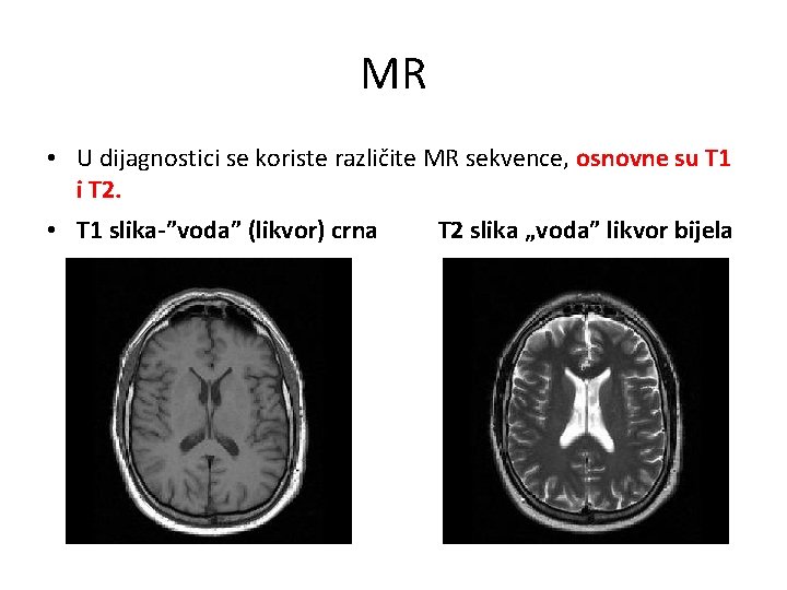 MEDICINSKA RADIOLOGIJA MR Dr sc Dragica Obad Kovaevi