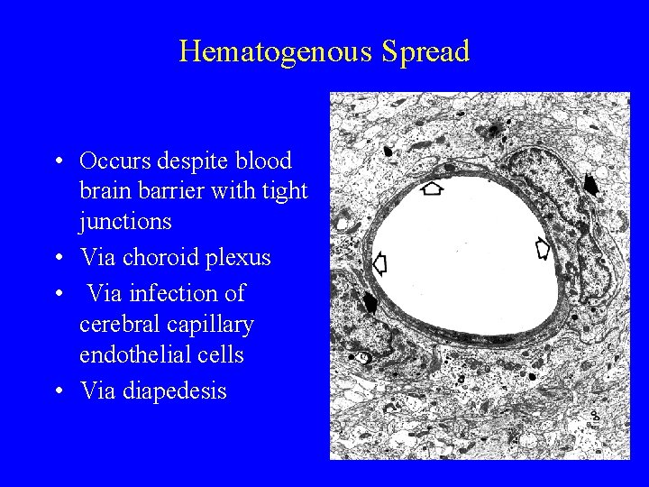 Viral Encephalitis Definitions Pathogenesis Epidemiology Clinical ...