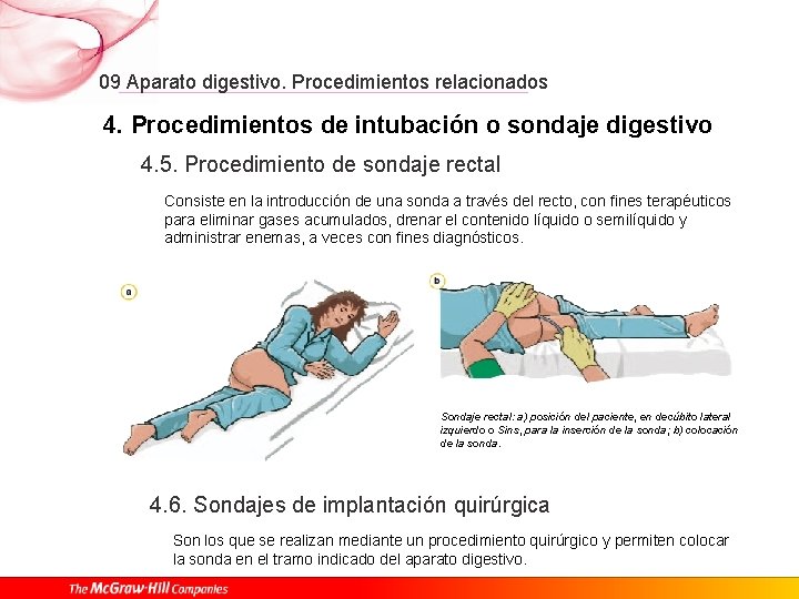 Tcnicas bsicas de enfermera Unidad 9 Aparato digestivo