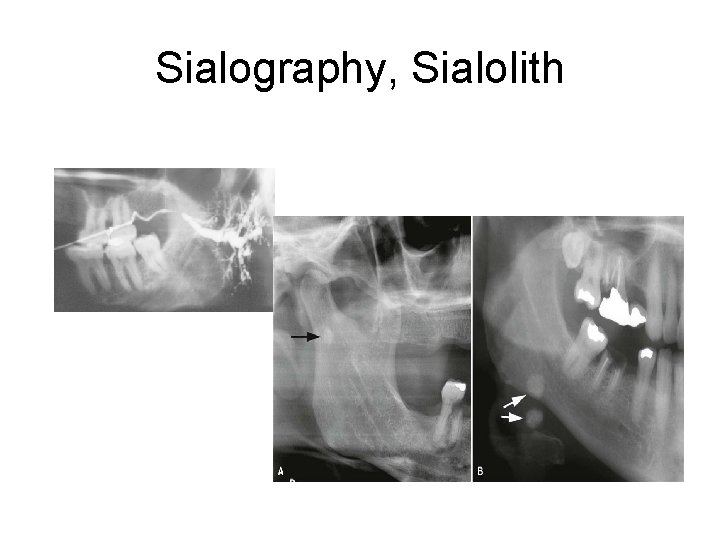 PAROTID GLAND Dr Shivarama Bhat Curtsey Slideshare Salivary