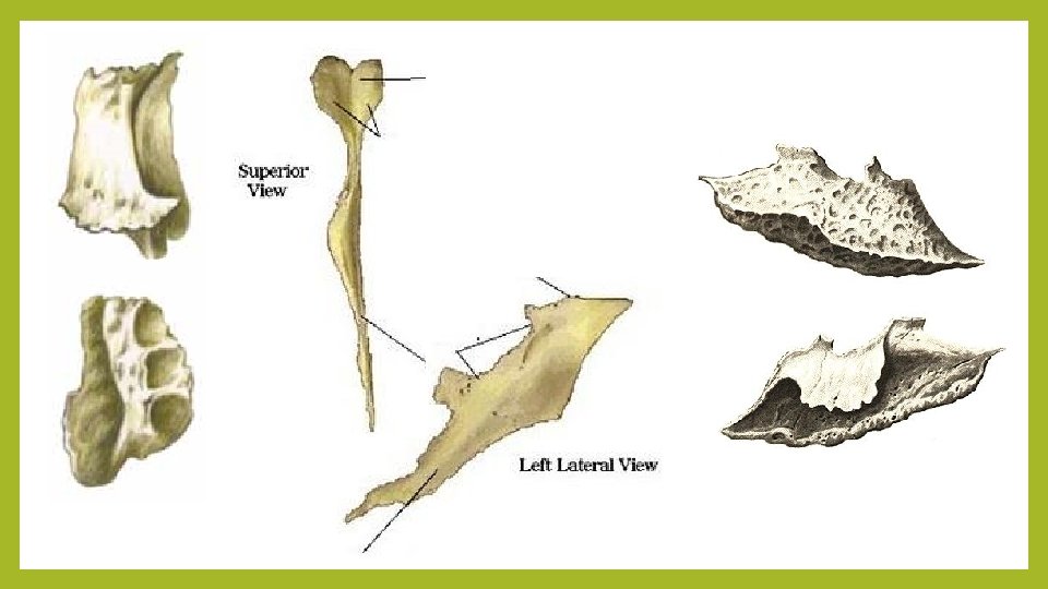 11 KOSTI VISCEROKRANIJA DETALJI MORFOLOGIJE I TOPOGRAFIJA Medicinska
