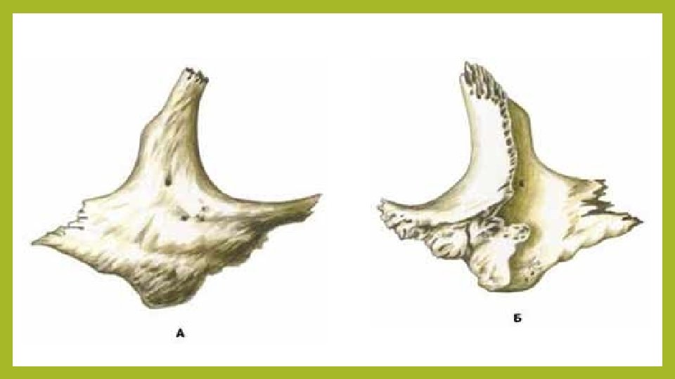 11 KOSTI VISCEROKRANIJA DETALJI MORFOLOGIJE I TOPOGRAFIJA Medicinska