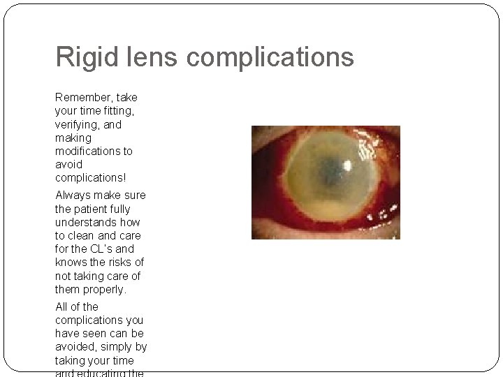 Rigid lens complications Week 12 Rigid lens complications