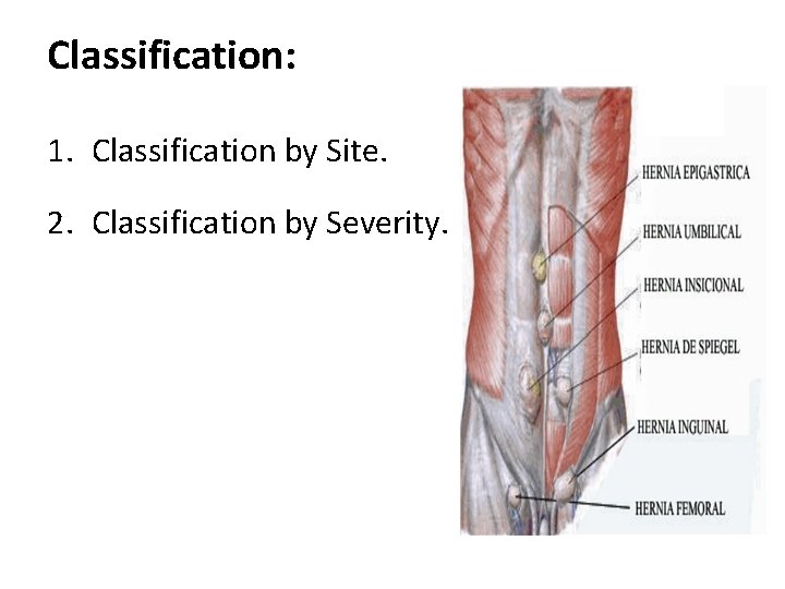 ABDOMINAL HERNIAS Fadi J Zaben RN MSN Definition
