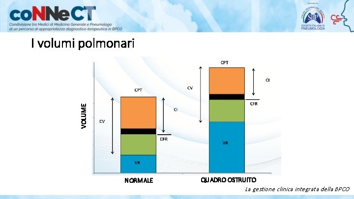Cenni di fisiopatologia respiratoria per una corretta prescrizione