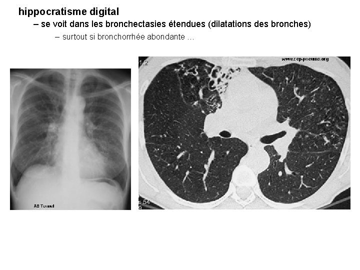 Les illustrations prsentes dans ce diaporama trouvent leurs