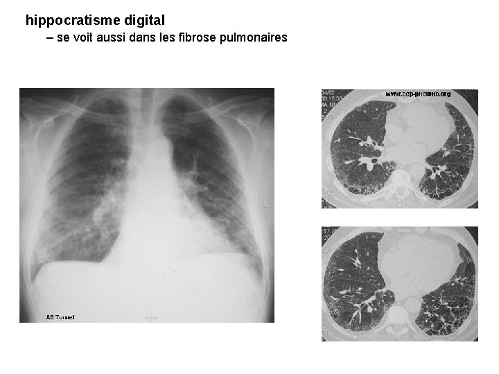 Les illustrations prsentes dans ce diaporama trouvent leurs