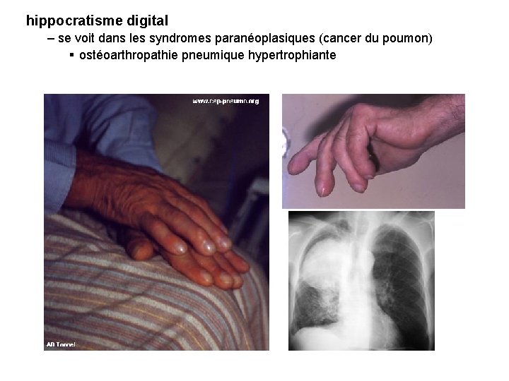 Les illustrations prsentes dans ce diaporama trouvent leurs