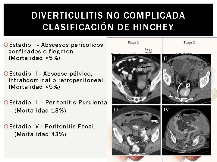 ENFERMEDAD DIVERTICULAR Dr Juan Pablo Carrizales Luna Residente
