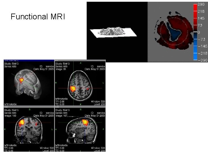 3 Nuclear Magnetic Resonance NMR results from resonant