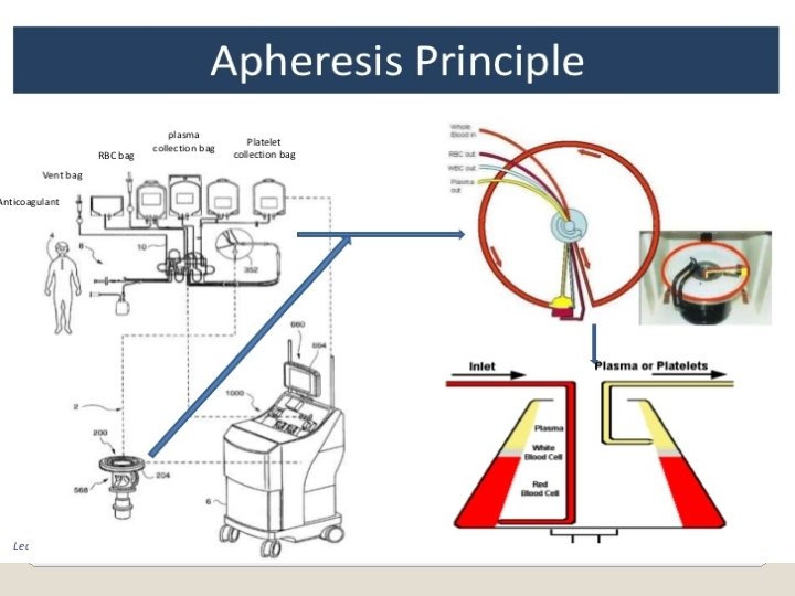 APHERESIS PRESENETED BY DR AKSHI GUPTA GUIDED BY